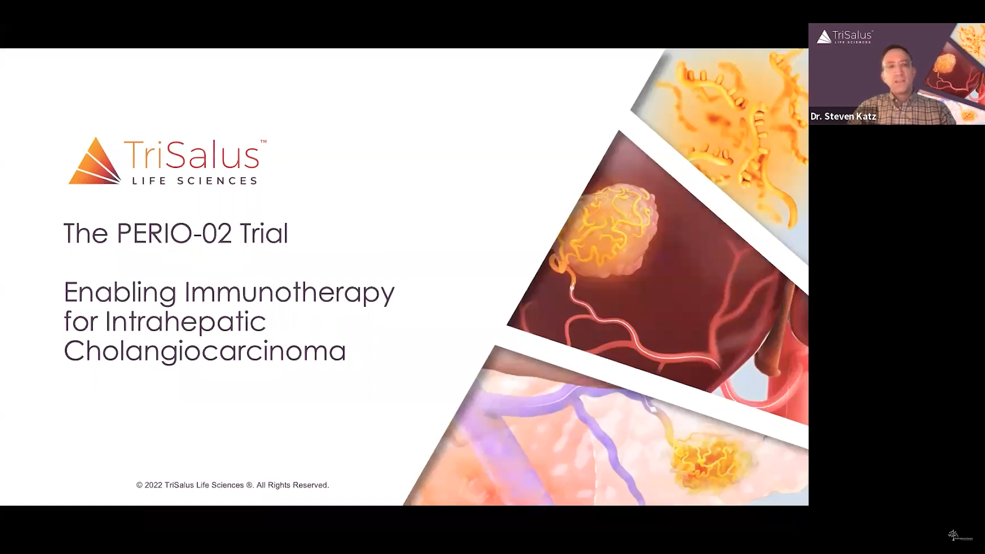 Webinar: “The PERIO-02 Trial – Enabling Immunotherapy for Intrahepatic ...